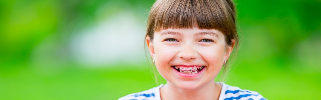 Brisbane braces – Inline Orthodontics